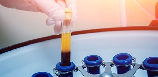 Blood Plasma Market: Global Trends You Need To Know Blood Plasma Market: Global Trends You Need To Know